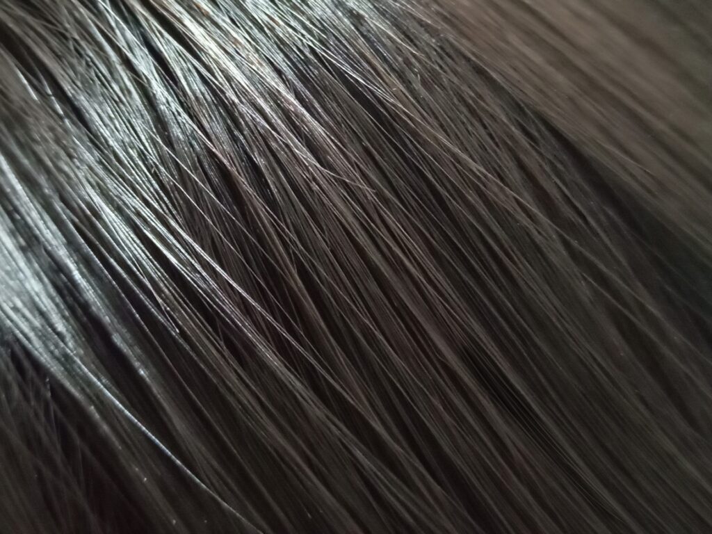 毛髪再生医療によるAGA治療｜PRP療法・幹細胞培養上清療法を解説 - 再生医療DOC-再生医療を提供するおすすめ名医を中心に掲載