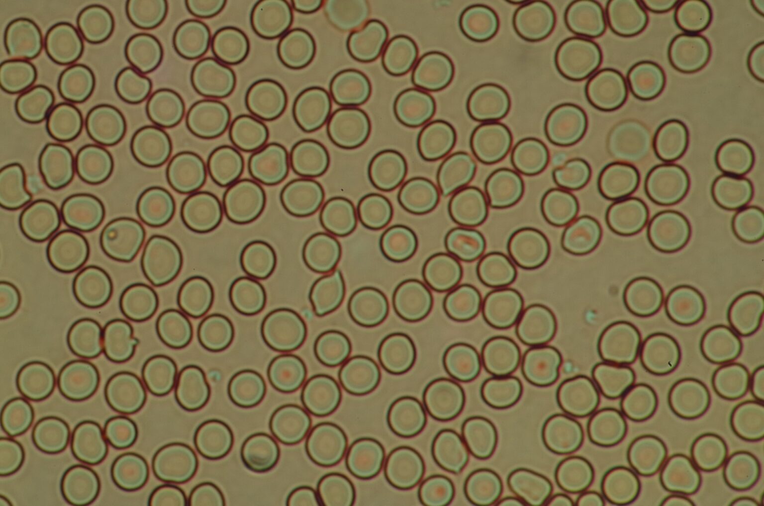 毛髪再生医療によるAGA治療｜PRP療法・幹細胞培養上清療法を解説 - 再生医療DOC-再生医療を提供するおすすめ名医を中心に掲載